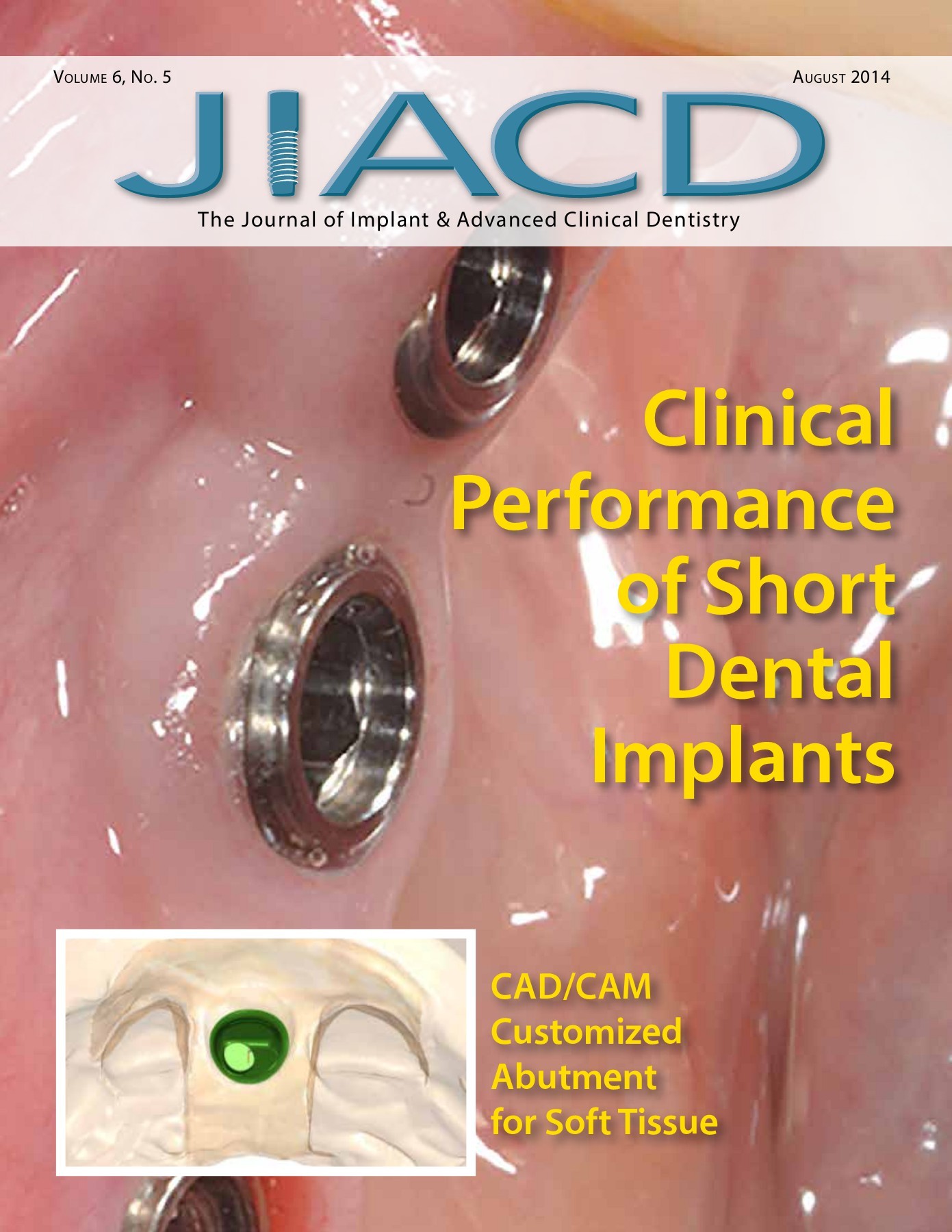 Journal of Implant and Advanced Clinical Dentistry August 2014 - JIACD ...
