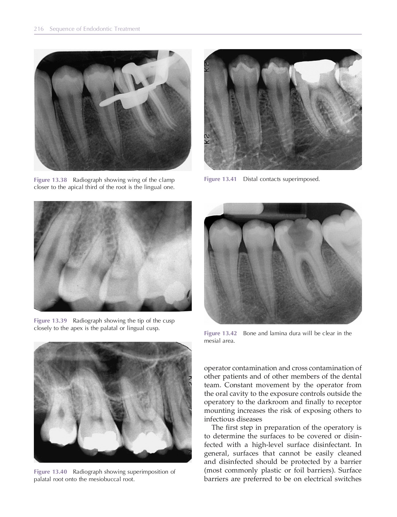 Endodontic radiology - DentLib CMU - Page 236 | Flip PDF Online | PubHTML5