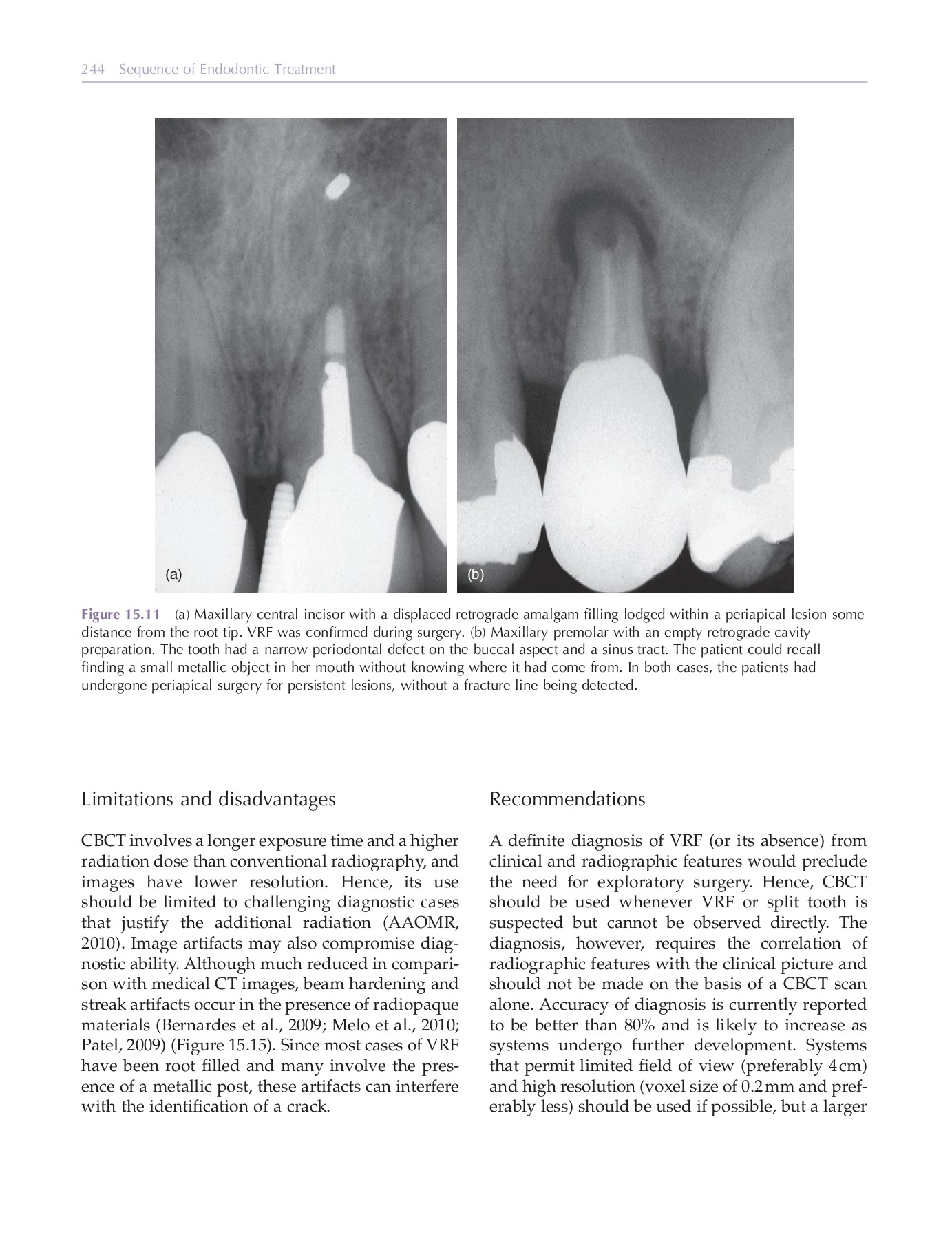 Endodontic radiology - DentLib CMU - Page 264 | Flip PDF Online | PubHTML5