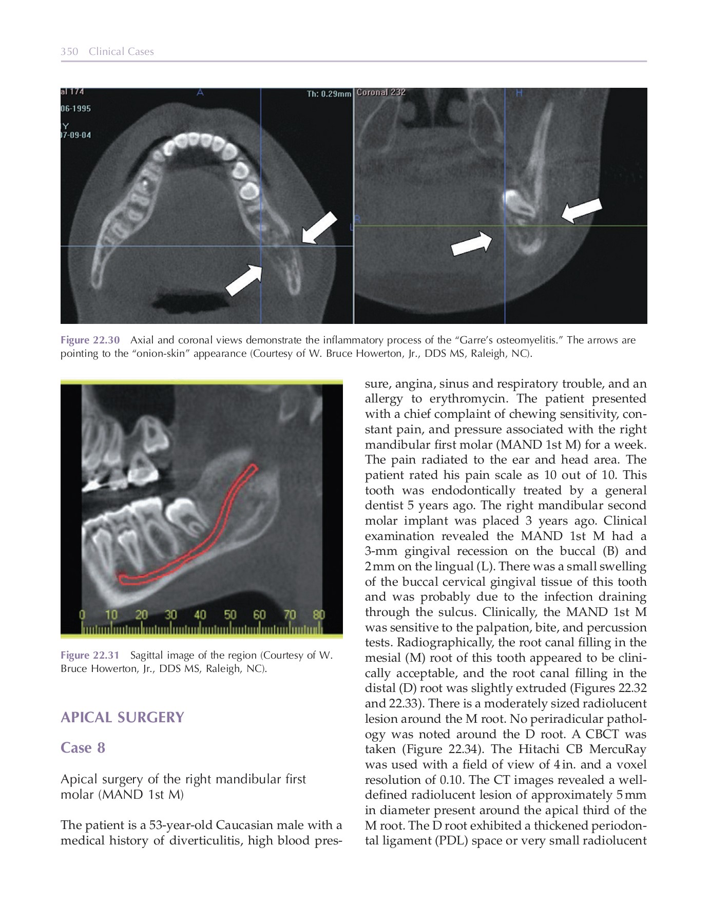 Endodontic radiology - DentLib CMU - Page 370 | Flip PDF Online | PubHTML5