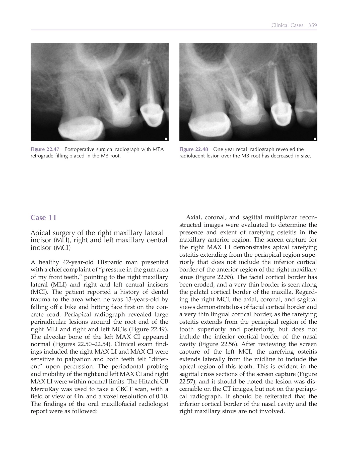 Endodontic radiology - DentLib CMU - Page 379 | Flip PDF Online | PubHTML5