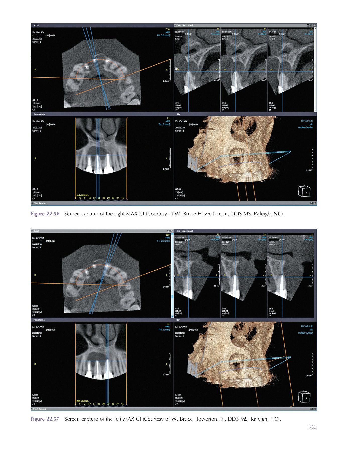 Endodontic radiology - DentLib CMU - Page 383 | Flip PDF Online | PubHTML5
