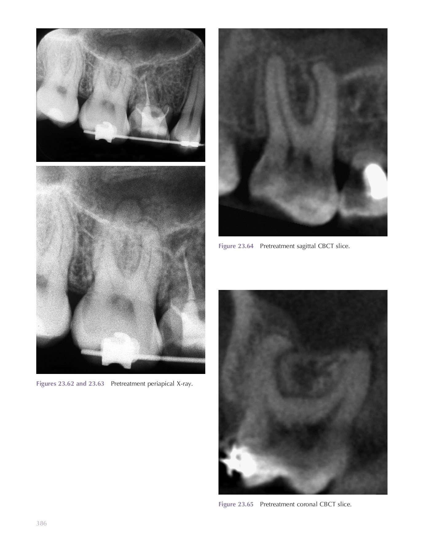 Endodontic radiology - DentLib CMU - Page 406 | Flip PDF Online | PubHTML5