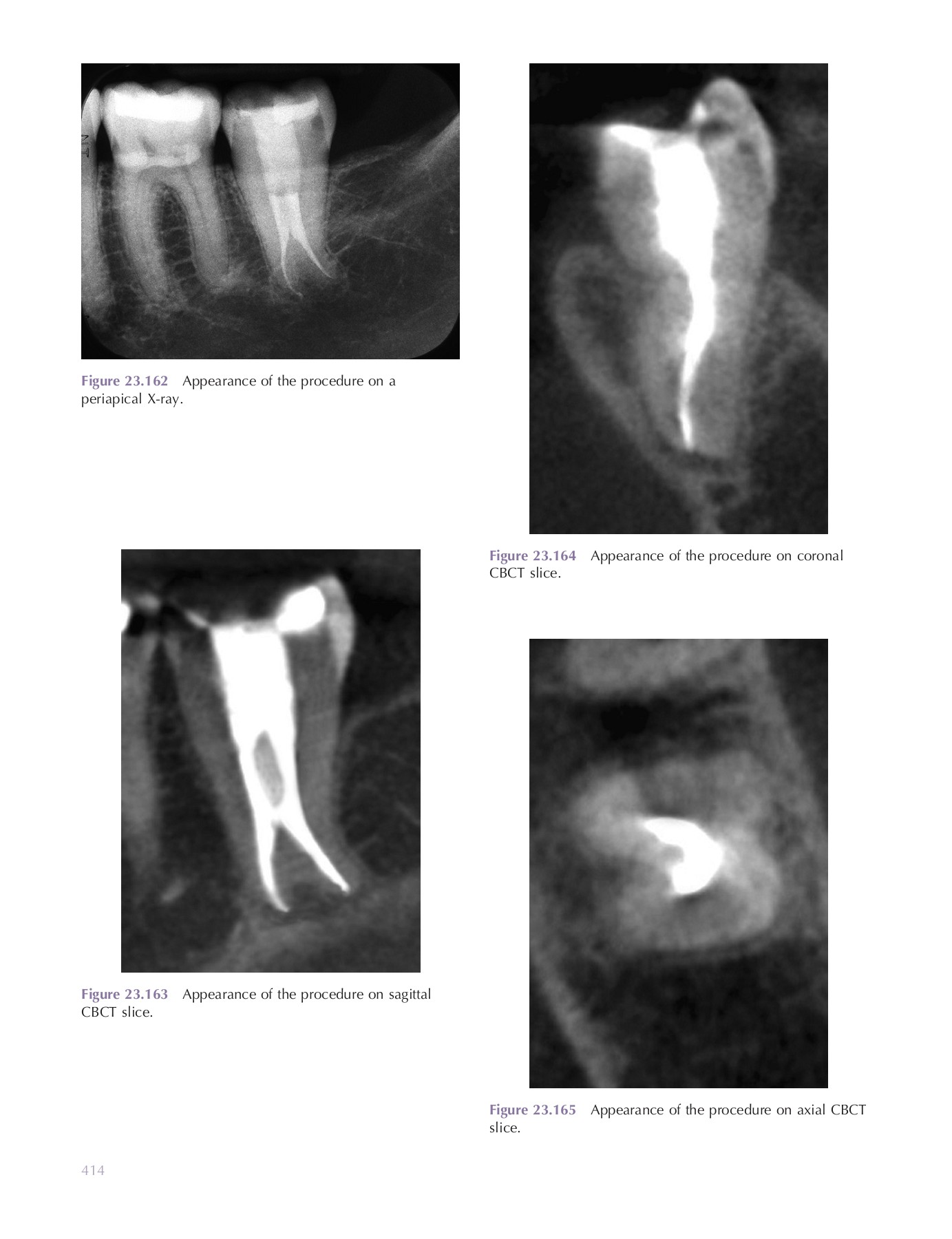 Endodontic radiology - DentLib CMU - Page 434 | Flip PDF Online | PubHTML5