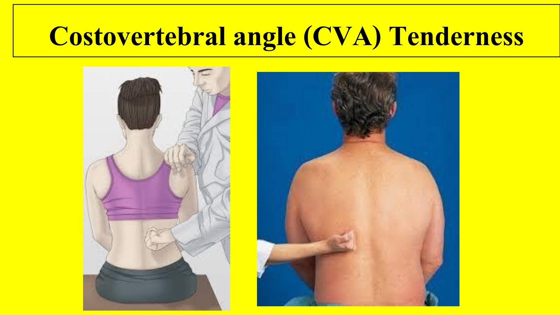 3.4 abdomen - SIRIKAN RAENOKASIKORN - หน้าหนังสือ 40 | พลิก PDF ออนไลน์ ...