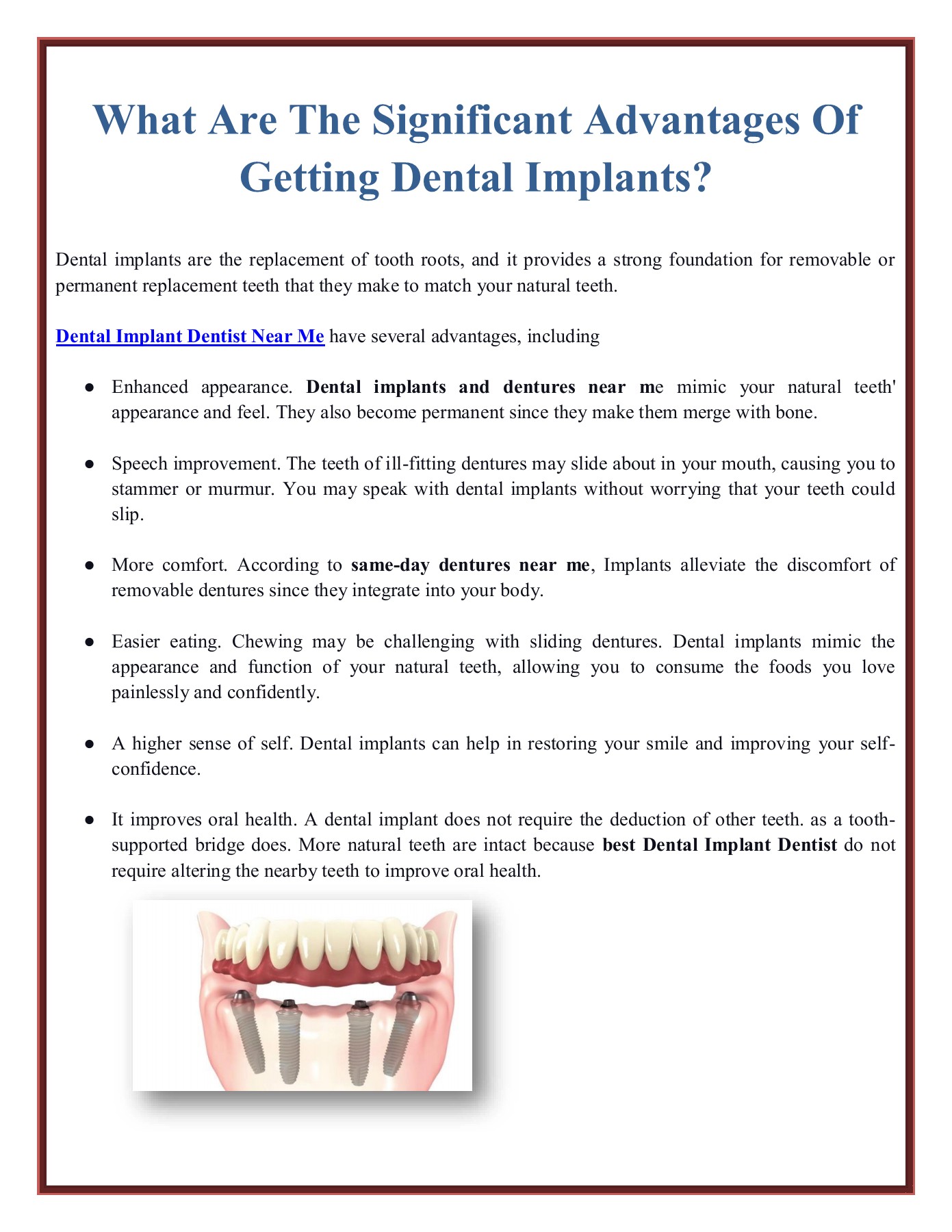 What Are The Significant Advantages Of Getting Dental Implants ...