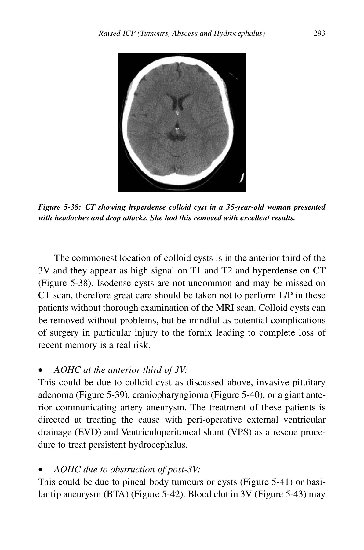 Problem Based Neurosurgery - Horizon College of Physiotherapy - Page 308 | Flip PDF Online ...