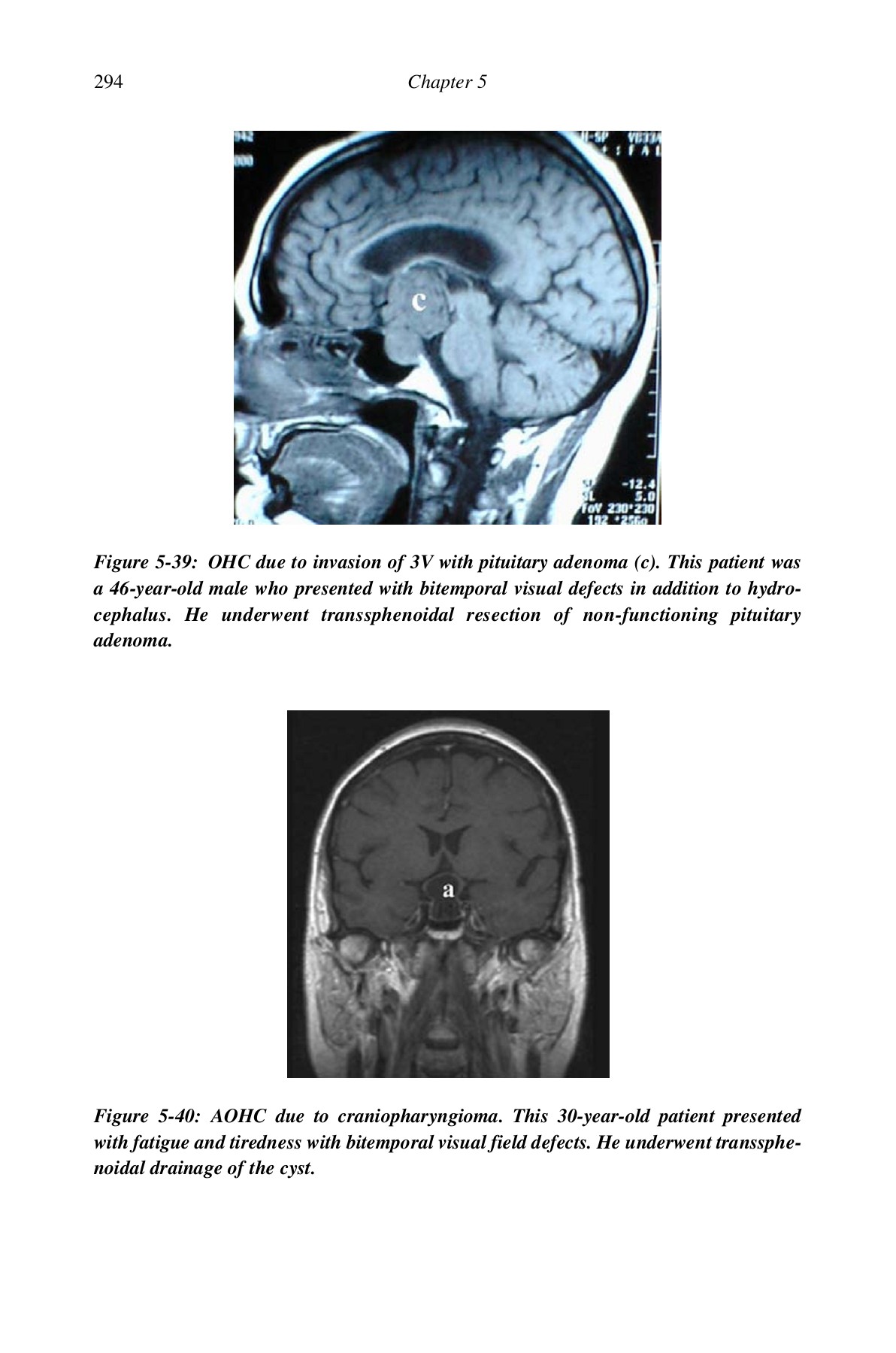 Problem Based Neurosurgery - Horizon College of Physiotherapy - Page 309 | Flip PDF Online ...