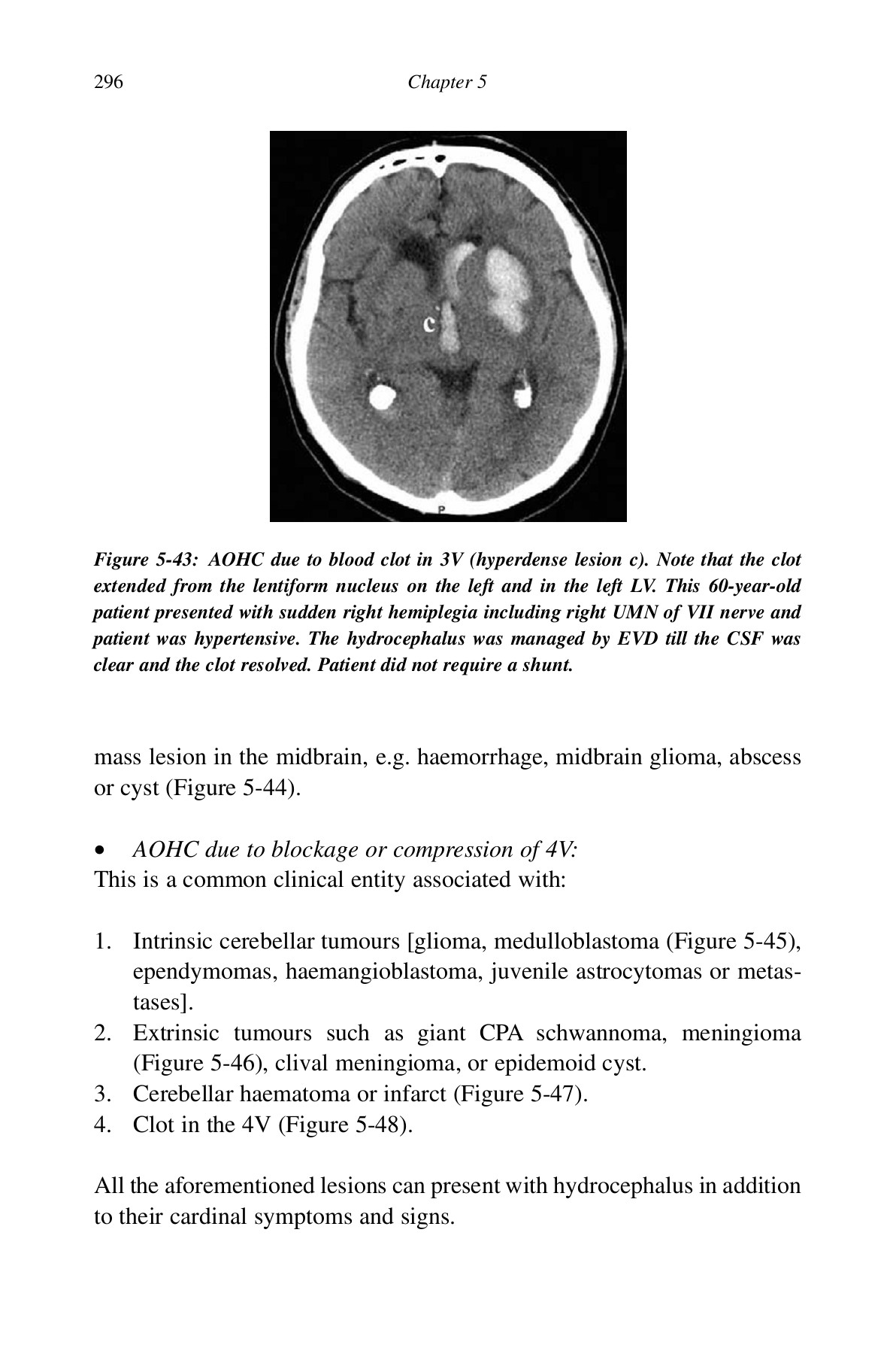 Problem Based Neurosurgery - Horizon College of Physiotherapy - Page 311 | Flip PDF Online ...