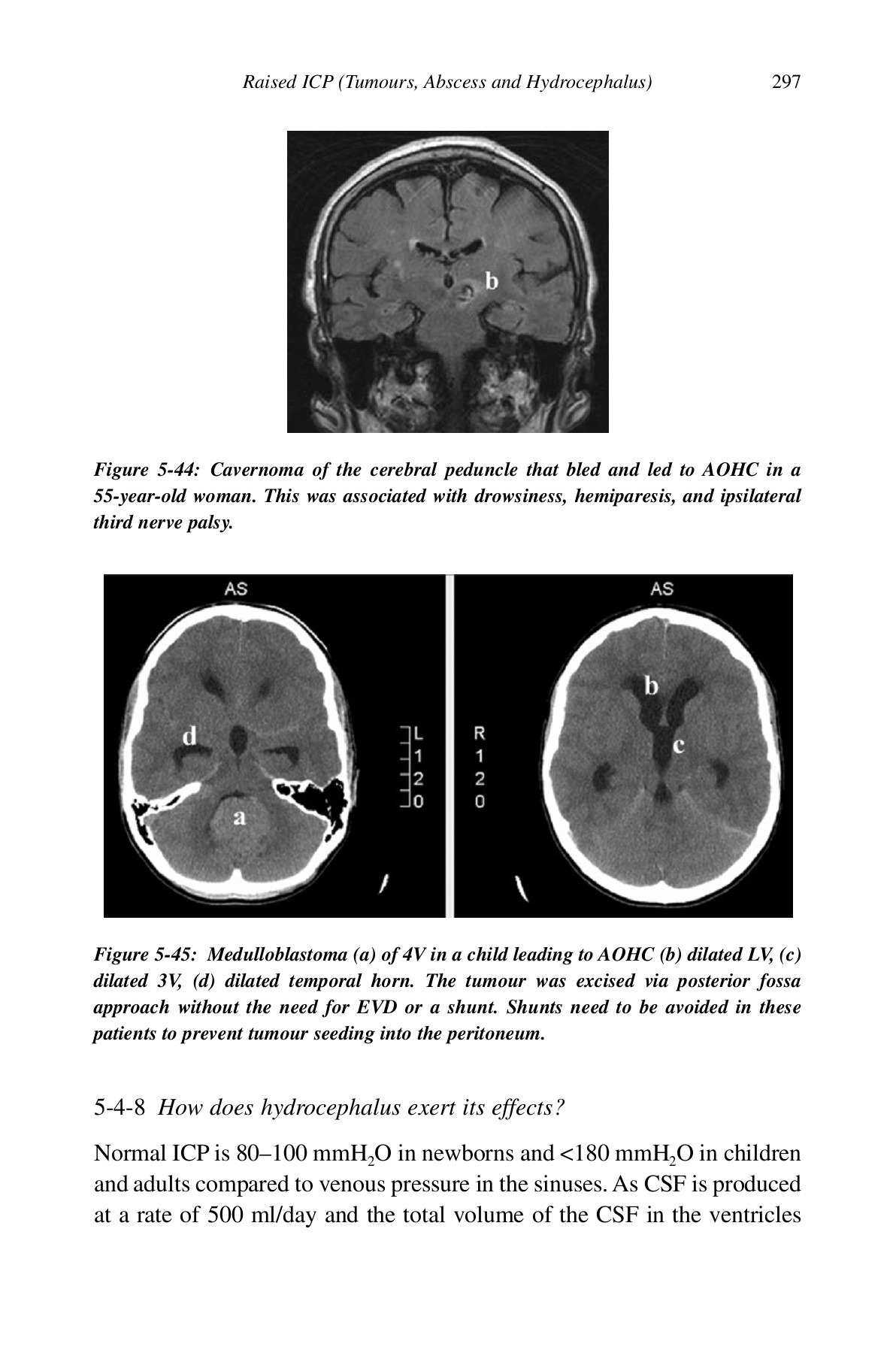 Problem Based Neurosurgery - Horizon College of Physiotherapy - Page 312 | Flip PDF Online ...