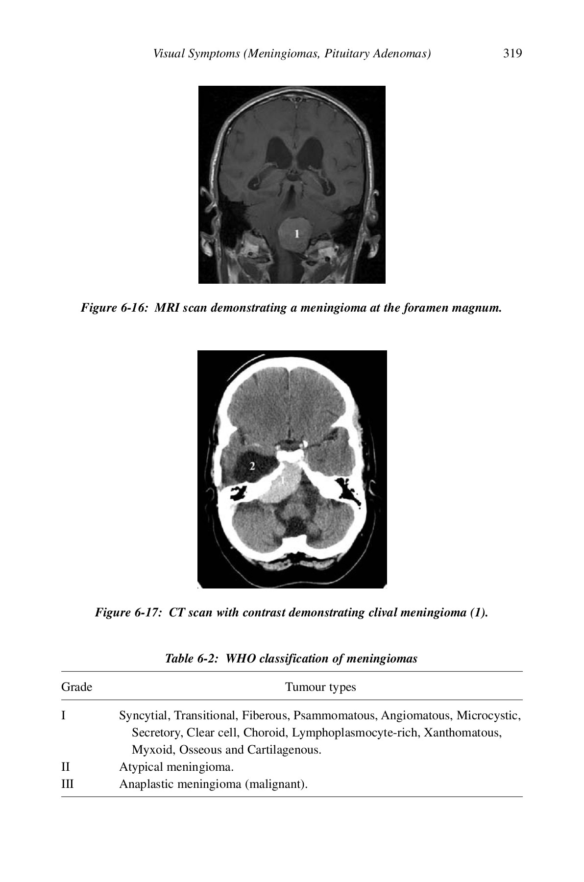 Problem Based Neurosurgery - LATE SURESHANNA BATKADLI COLLEGE OF PHYSIOTHERAPY - Page 334 | Flip ...
