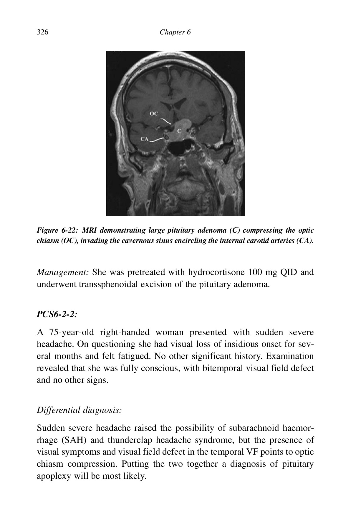 Problem Based Neurosurgery - Horizon College of Physiotherapy - Page 341 | Flip PDF Online ...