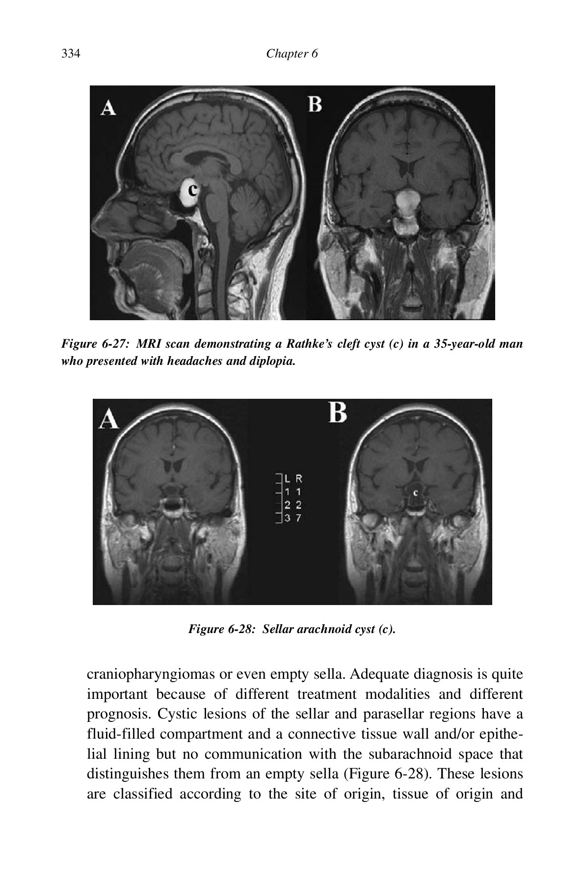 Problem Based Neurosurgery - Horizon College of Physiotherapy - Page 349 | Flip PDF Online ...