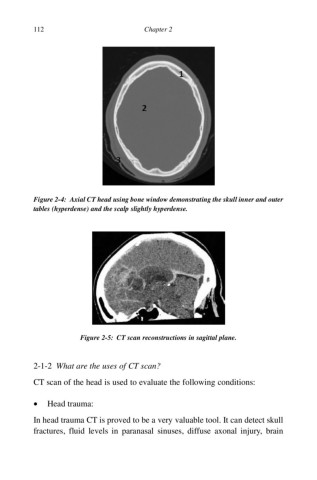 Problem Based Neurosurgery - Horizon College of Physiotherapy - Page 127 | Flip PDF Online ...