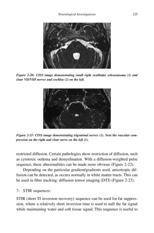 Problem Based Neurosurgery - Horizon College of Physiotherapy - Page 140 | Flip PDF Online ...