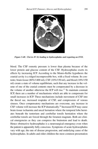 Problem Based Neurosurgery - Horizon College of Physiotherapy - Page 314 | Flip PDF Online ...