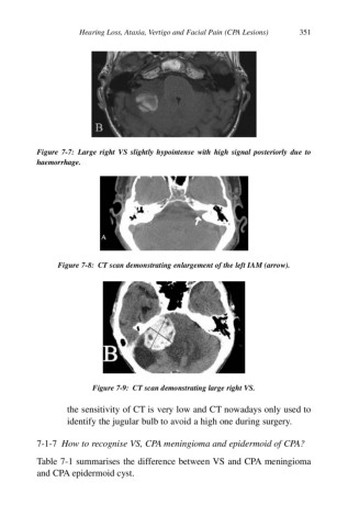 Problem Based Neurosurgery - Horizon College of Physiotherapy - Page 366 | Flip PDF Online ...