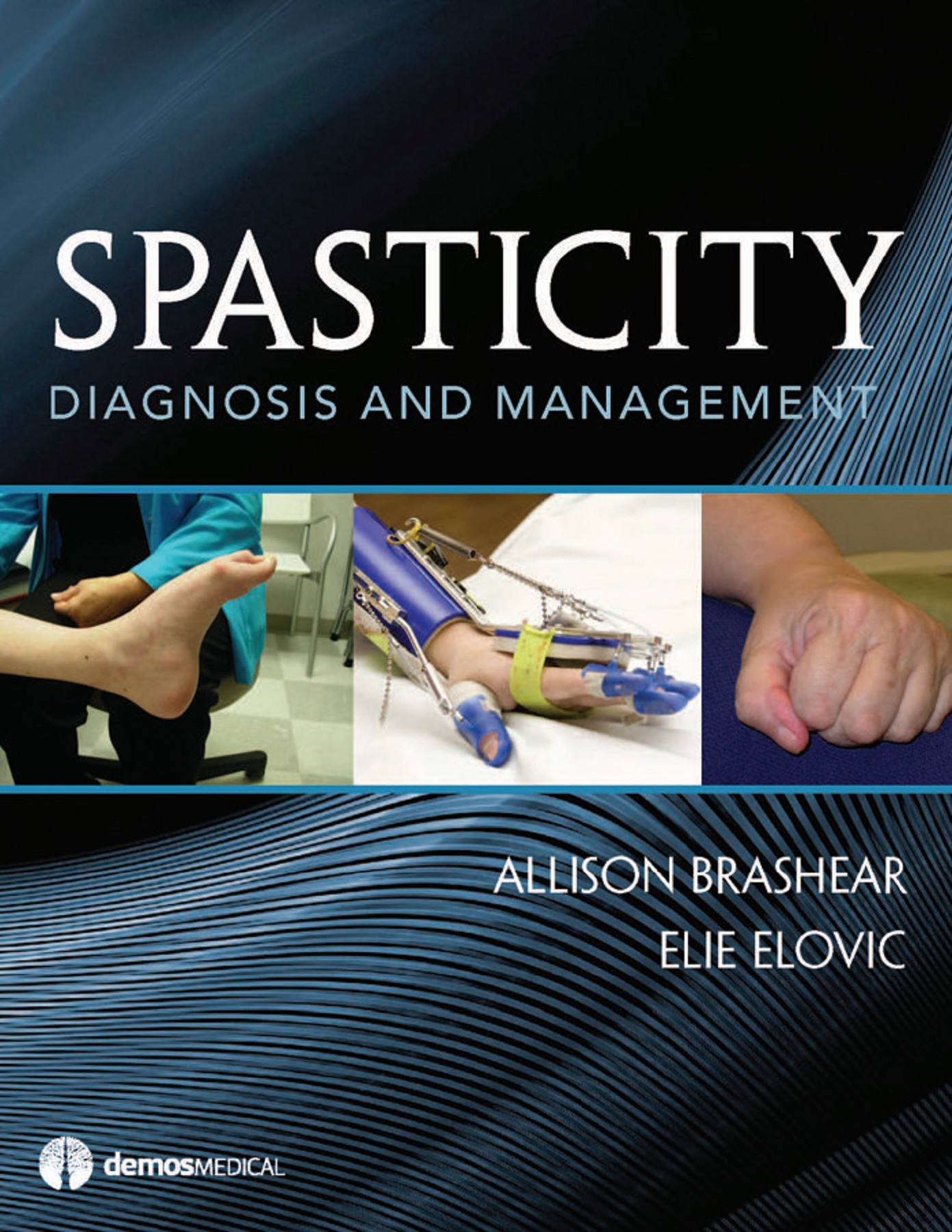 Spasticity Diagnosis and Management - LATE SURESHANNA BATKADLI COLLEGE ...