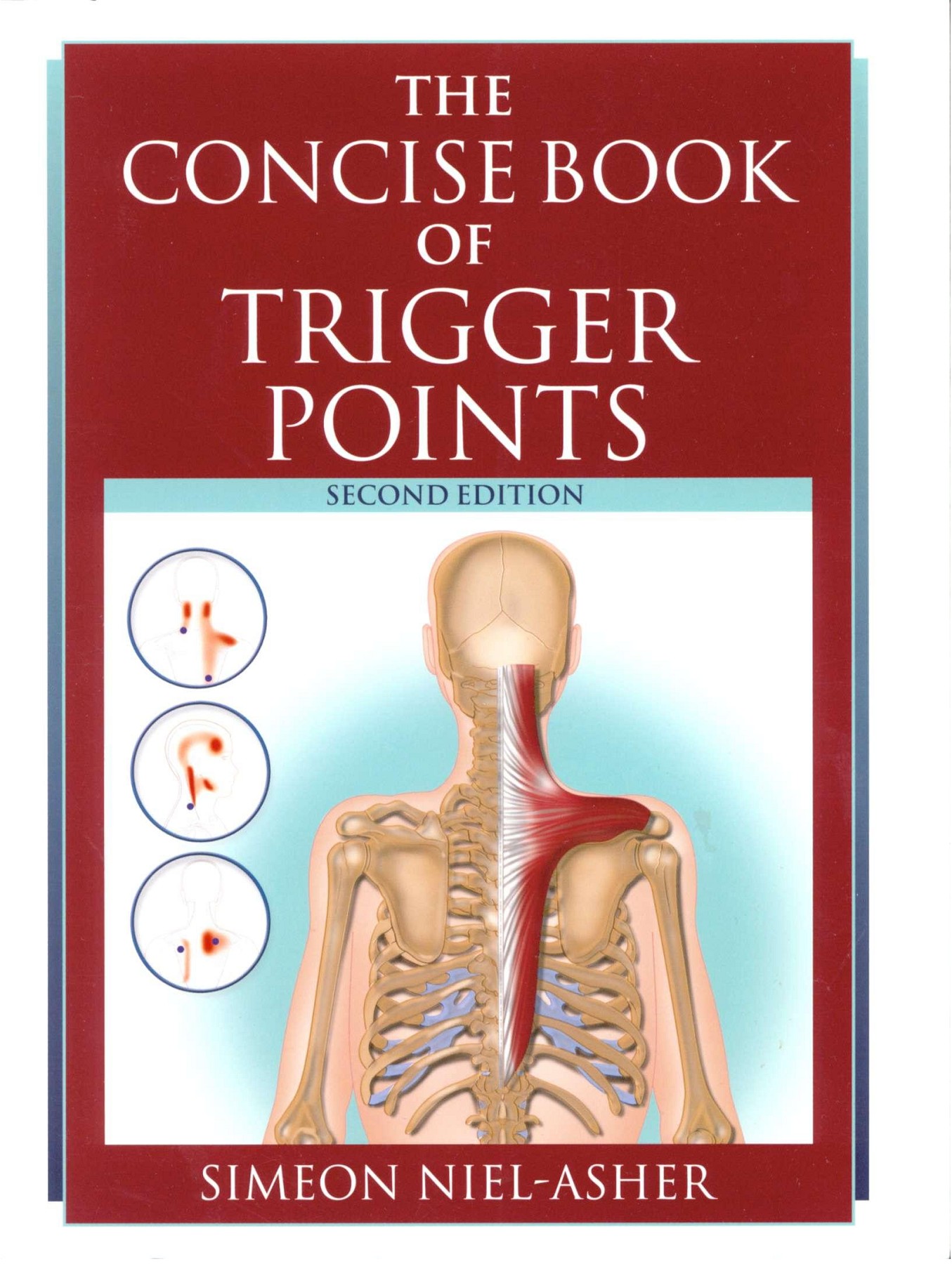 Concise Book of Trigger Points - LATE SURESHANNA BATKADLI COLLEGE OF ...