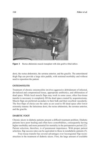 Lower Extremity Trauma Edited by Milton B. Armstrong - Horizon College ...