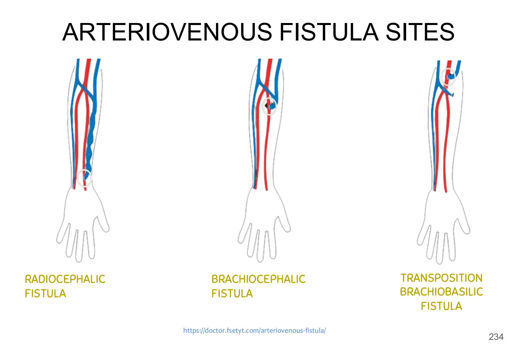 VASCULAR ACCESS DEVICES - ceo.webrn - Page 234 | Flip PDF Online | PubHTML5