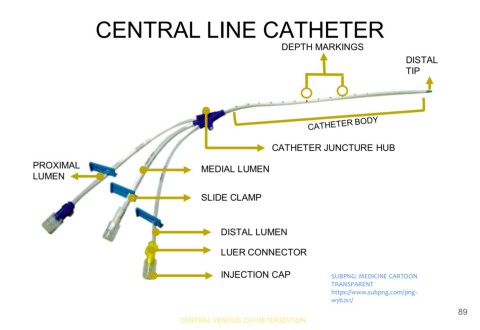 VASCULAR ACCESS DEVICES - ceo.webrn - Page 89 | Flip PDF Online | PubHTML5