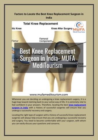 Factors to Locate the Best Knee Replacement Surgeon in India
