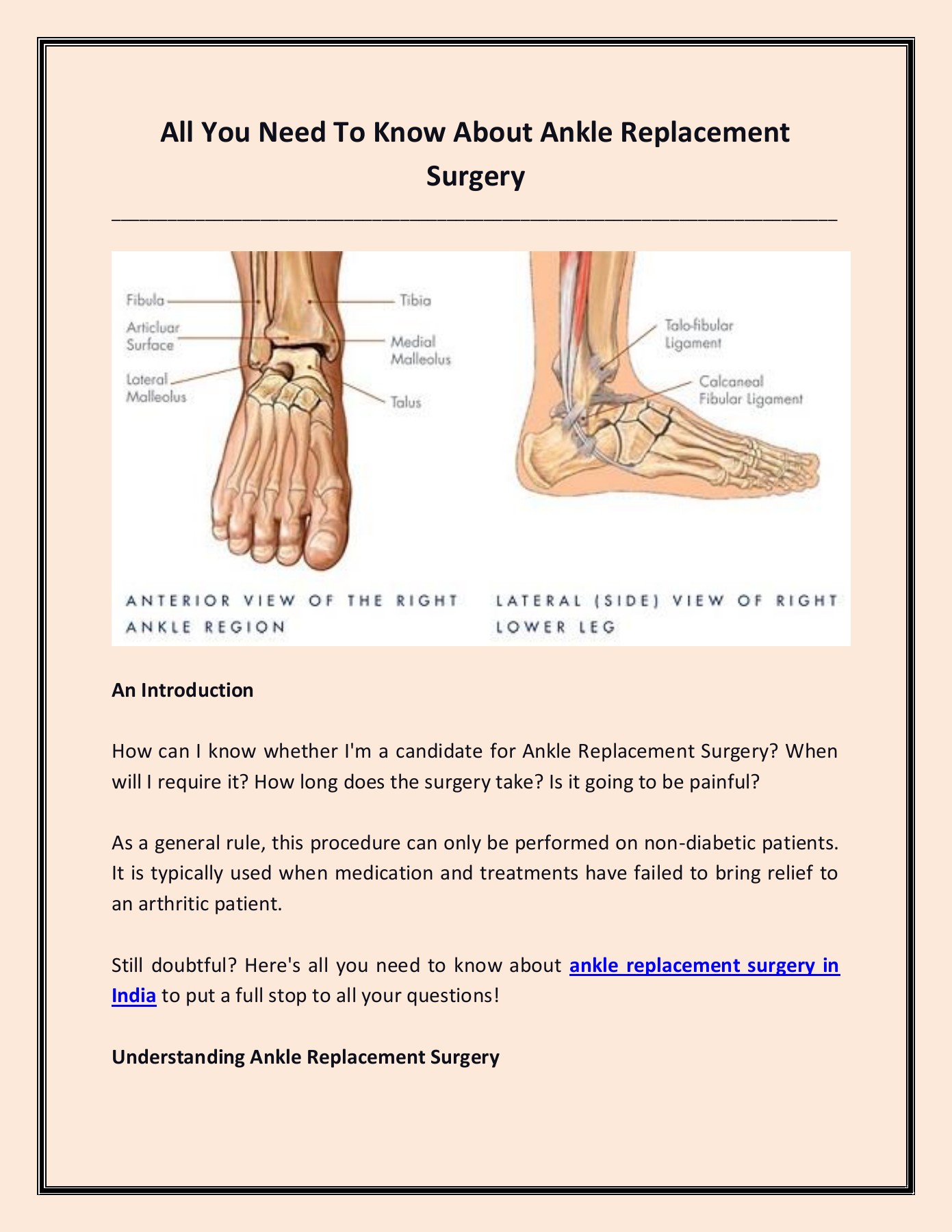 All You Need To Know About Ankle Replacement Surgery - Mufamedi Tourism ...