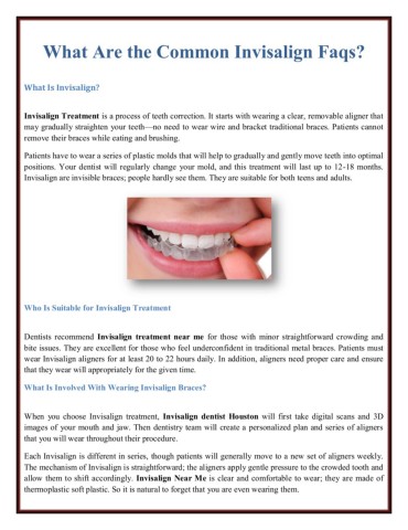 What Are the Common Invisalign Faqs?