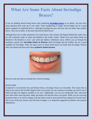 What Are Some Facts About Invisalign Braces?