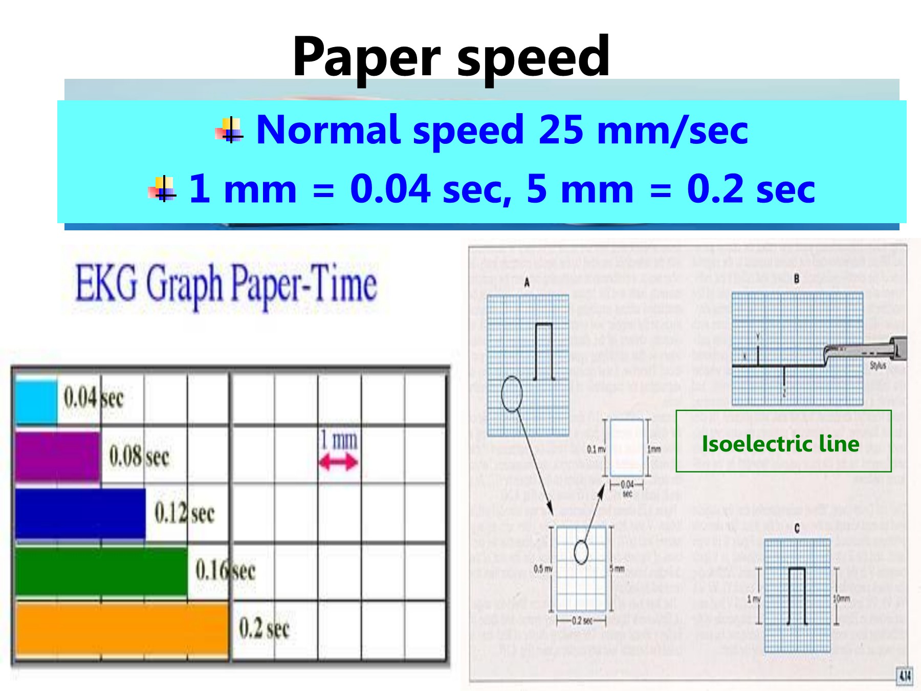 Basic EKG for Nurse - porntana22 - Page 55 | Flip PDF Online | PubHTML5