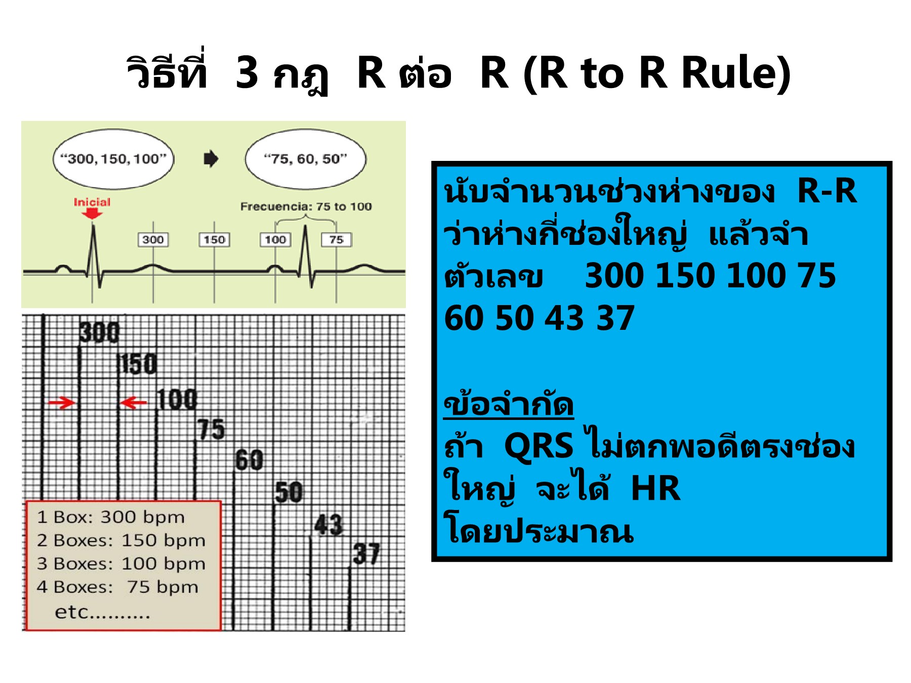 Basic EKG for Nurse - porntana22 - Page 64 | Flip PDF Online | PubHTML5