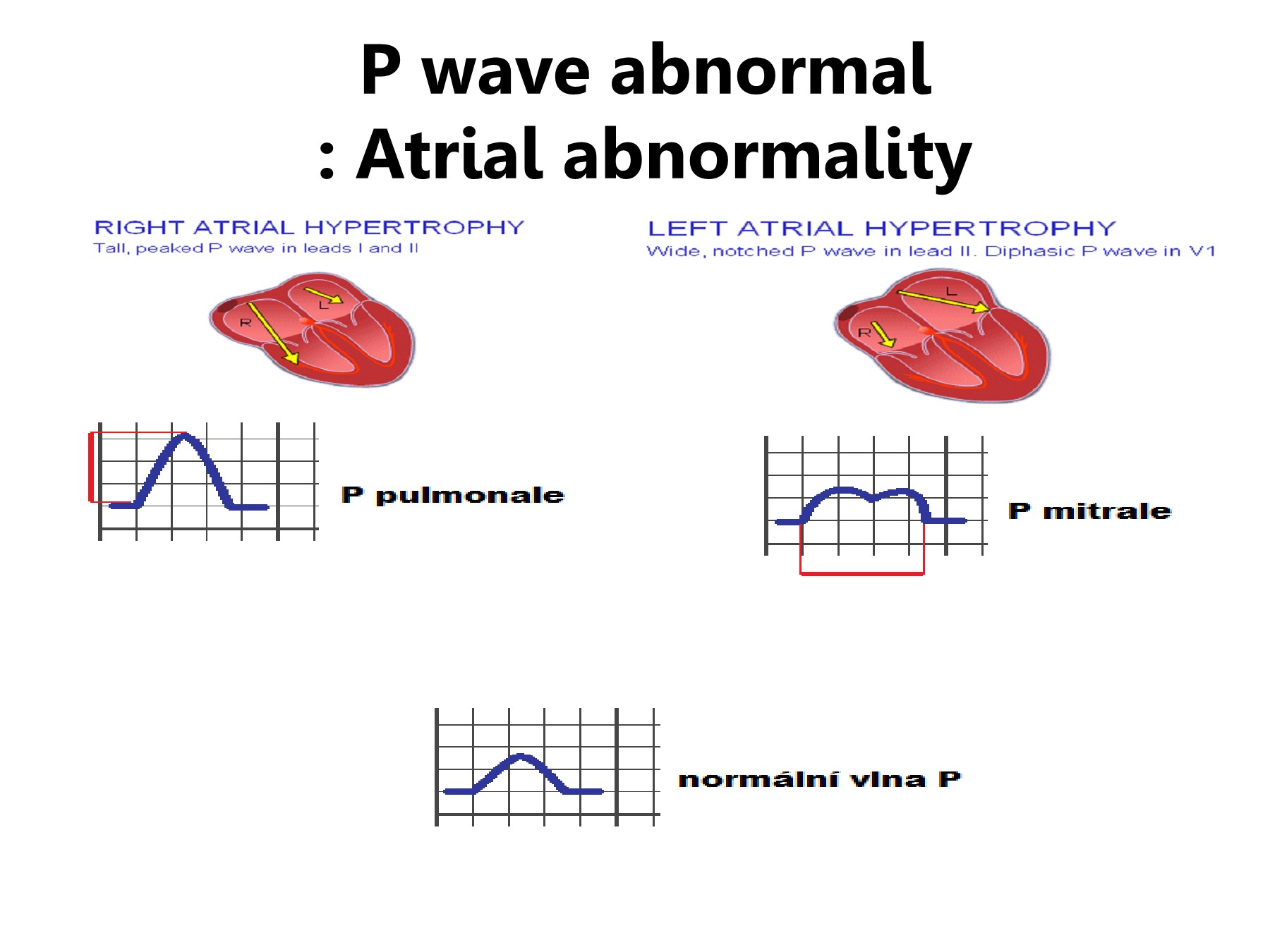 Basic EKG for Nurse - porntana22 - Page 73 | Flip PDF Online | PubHTML5